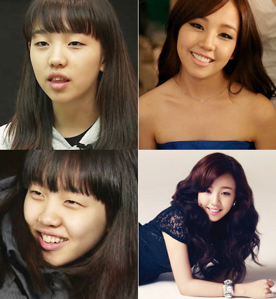 Baek Ah Yeon Teeth Baek Hyeon NamuWiki